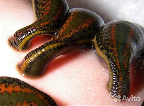Продам пиявки